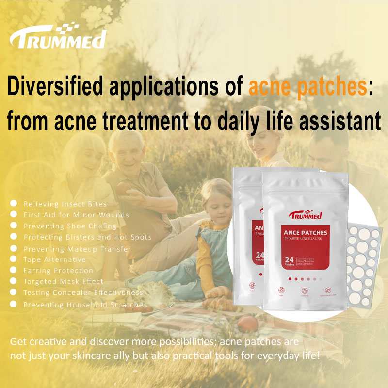 Diversified applications of acne patches: from acne treatment to daily ...